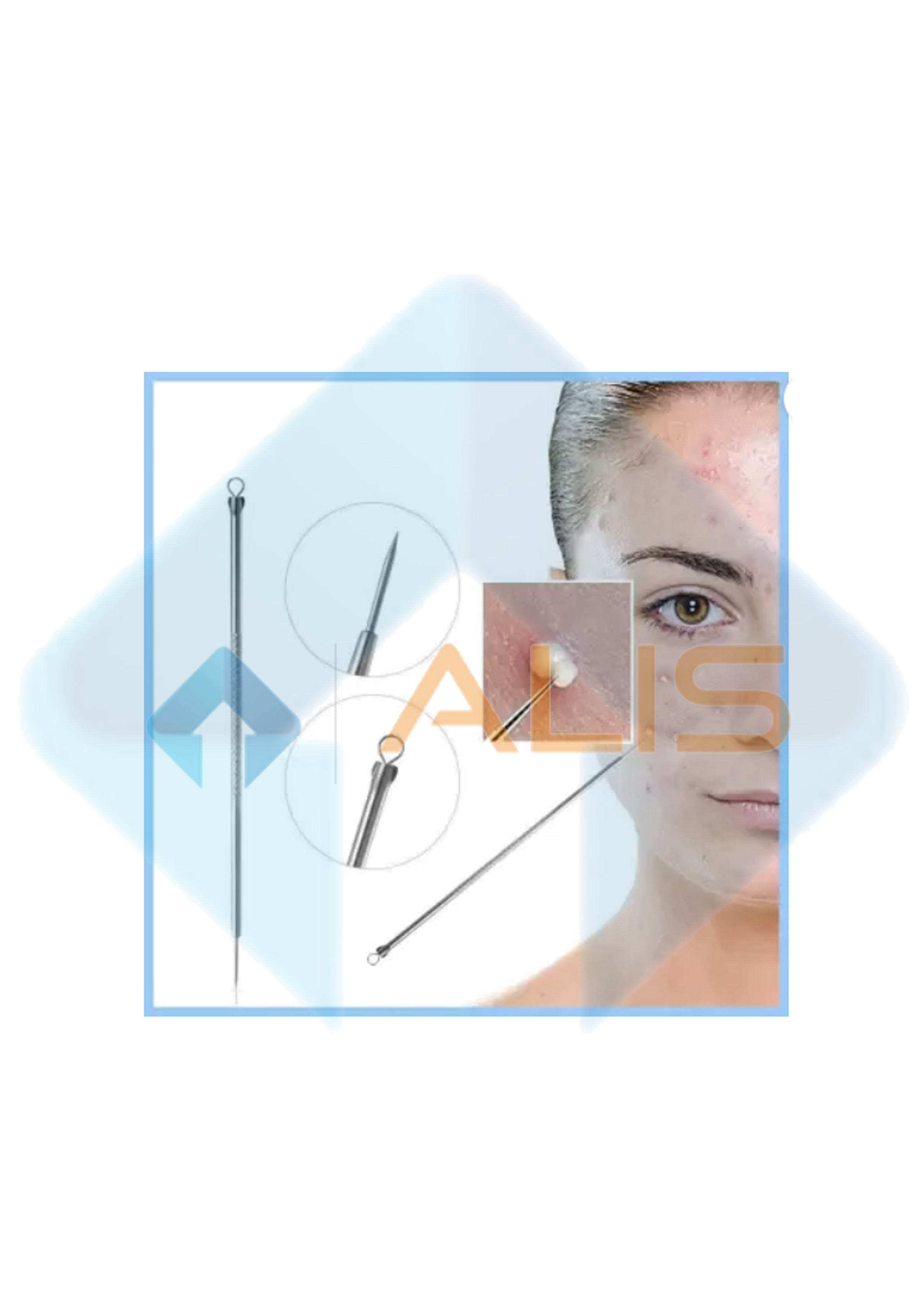 Acne Extractor Kit - Tweezer, Needle Loop, Scoop Loop for Ingrown Hair ...